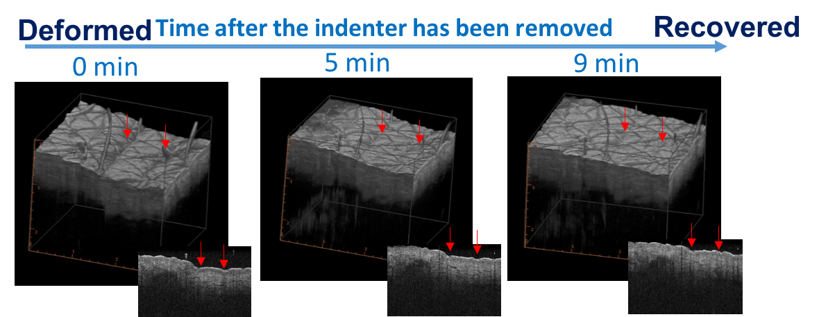 Skin Imaging | Biophotonics Imaging Laboratory | Illinois
